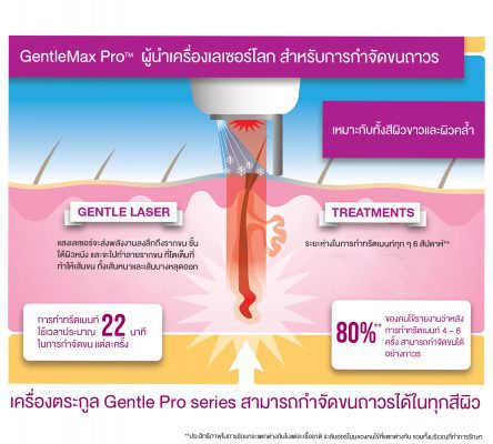 Gentle Max – BEAMED